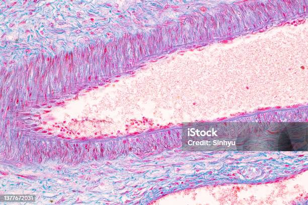 Anatomi Dan Ovarium Histologis Testis Dan Sperma Sel Manusia Di Bawah
