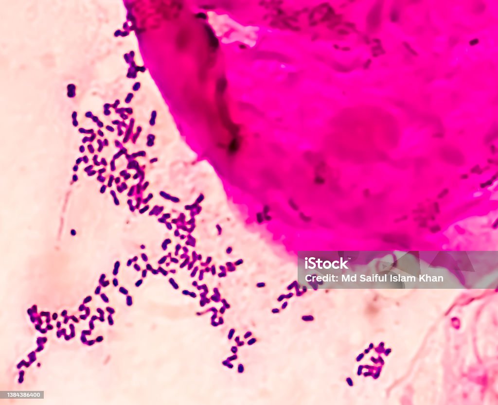 Gram Stain Gram Positive Cocci Gram Positive Diplococci Bacteria And Squamous Epithelium Under