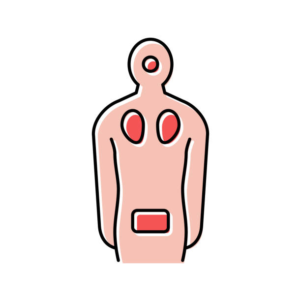 60 Pressure Ulcer Stock Illustrations Royalty Free Vector Graphics And Clip Art Istock