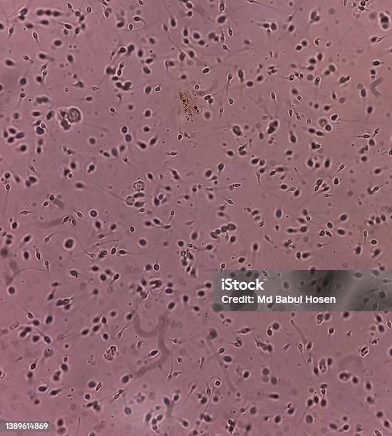 Analisis Air Mani Analisis Sperma Pada Pemeriksaan Mikroskopis