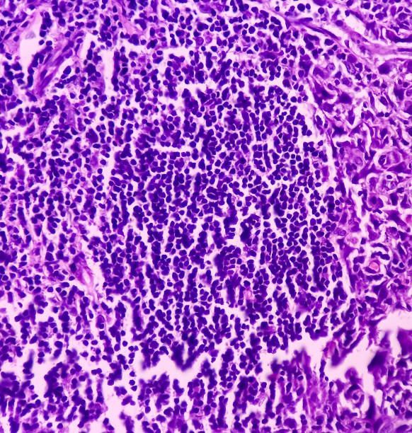 Tonsils