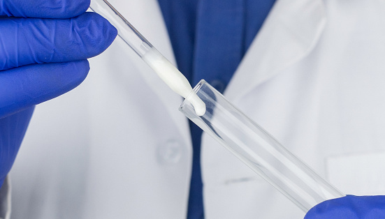 Asisten Laboratorium Medis Memeriksa Tabung Reaksi Dengan Sperma