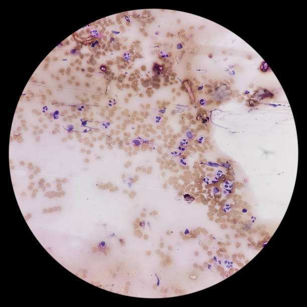 Free picture: blood smear, micrograph, vivax, ring, chromatin, dots ...