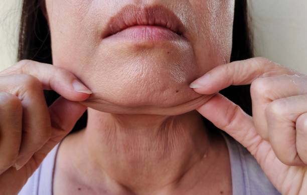 Skin Problems Solution Lotion Stock Photos, Pictures & Royalty-Free ... Skin Problems Solution Lotion Stock Photos, Pictures & Royalty-Free ...
