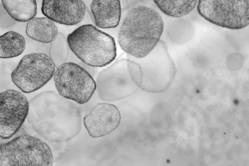 Imágenes De Virus De La Influenza A Descarga Imágenes Gratuitas En Unsplash