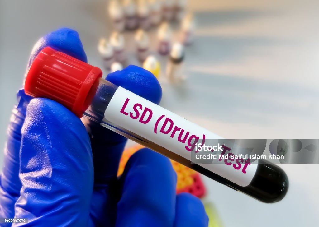 Sampel Darah Untuk Obat Doping Menguji Tes Lsd Di Laboratorium Medis