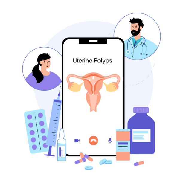 90 Cervical Polyps Stock Illustrations Royalty Free Vector Graphics