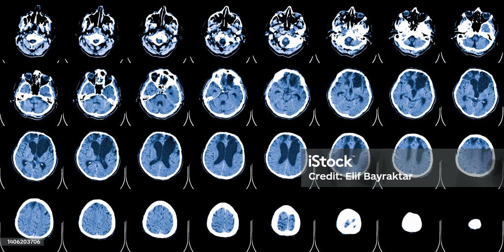 Pemindaian Mri Otak Pemindaian Pencitraan Resonansi Magnetik Latar ... Pemindaian Mri Otak Pemindaian Pencitraan Resonansi Magnetik Latar ...