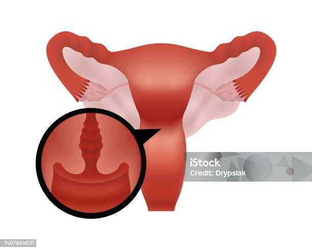 Realistic Illustration Of Female Human Reproductive System On White