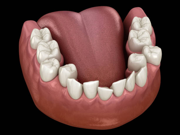 3,000+ Free Teeth & Mouth Images - Pixabay