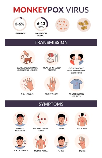 Monkeypox Virus Übertragung Und Symptome Flache Vektor Infografik ... Monkeypox Virus Übertragung Und Symptome Flache Vektor Infografik ...