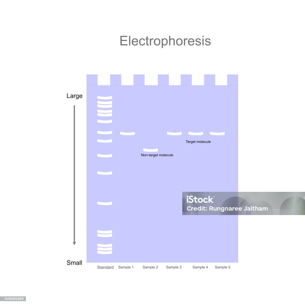 Hasil Interpretasi Deteksi Dna Target Dengan Teknik Elektroforesis Gel ... Hasil Interpretasi Deteksi Dna Target Dengan Teknik Elektroforesis Gel ...