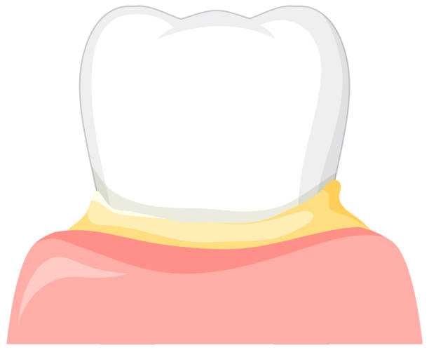 100 Root Canal Cartoon Stock Illustrations Royalty Free Vector Graphics And Clip Art Istock