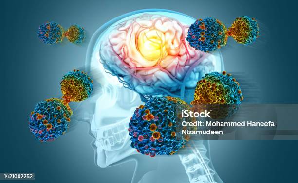 Células Cancerosas Que Atacan Un Cerebro Humano Ilustración 3d Foto de ... Células Cancerosas Que Atacan Un Cerebro Humano Ilustración 3d Foto de ...