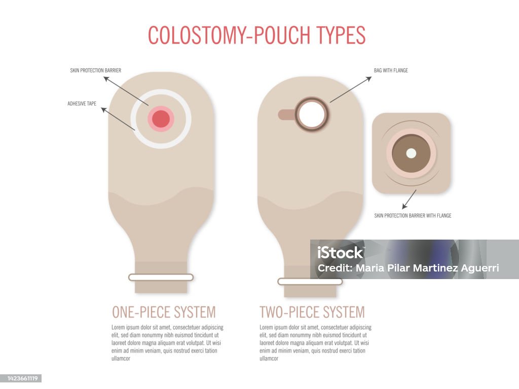 Types Of Colostomy Bags One Or Two Pieces Indicating Their Components On White Background Stock