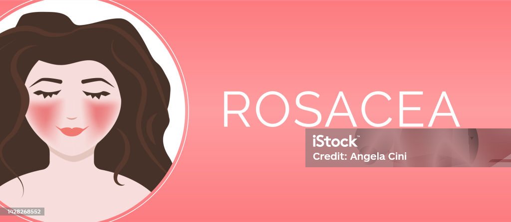 Rosacea Pink Skin Illness Background Illustration Stock Illustration Download Image Now