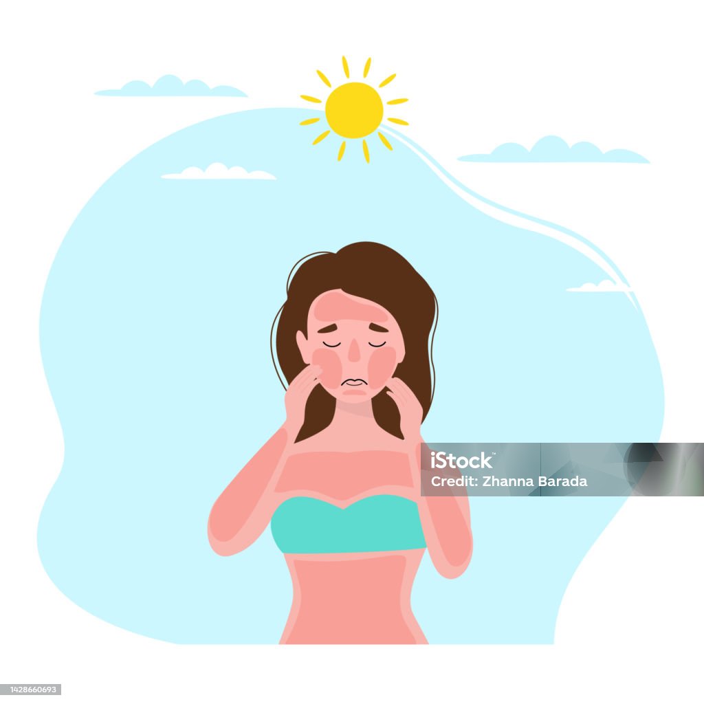 Vector Illustration Of Sunburn Stock Illustration Download Image Now