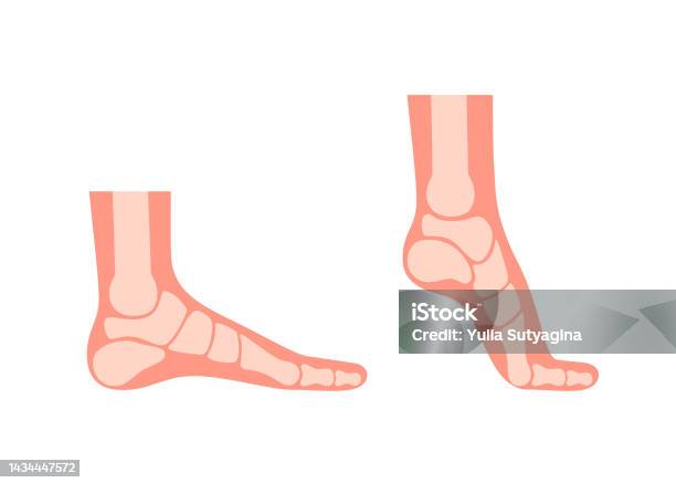 Silhouette Human Foot With Bones Orthopedic Leg Healthy Feet Full Foot And Tiptoe Foot Normal