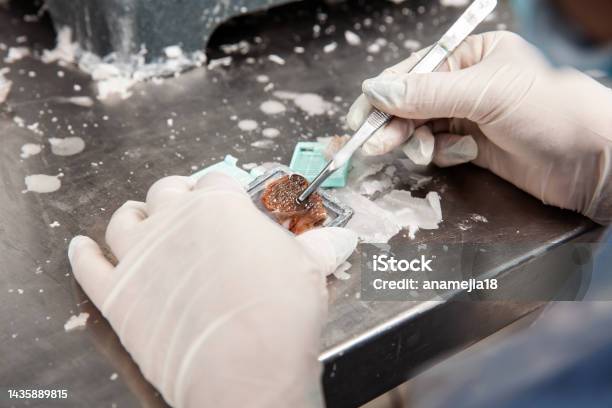 Scientist Embedding Tissues In Paraffin Blocks For Sectioning Pathology