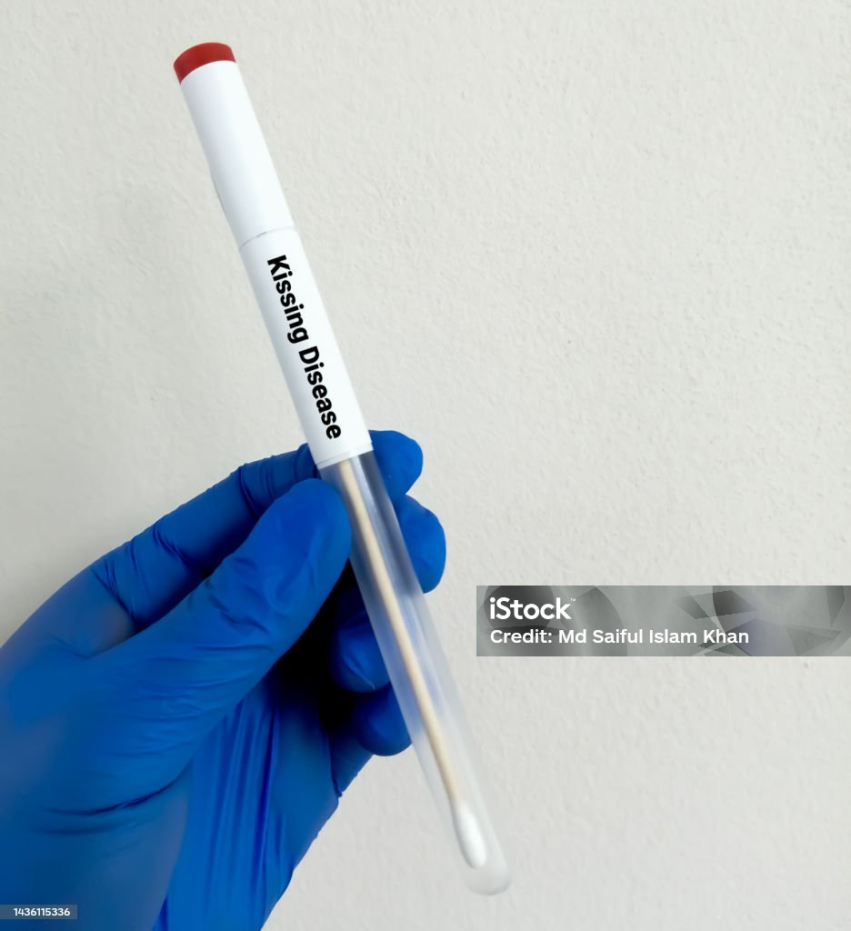 Ilmuwan Memegang Sampel Air Liur Untuk Diagnosis Penyakit Ciuman Penyakit Oleh Virus Epsteinbarr