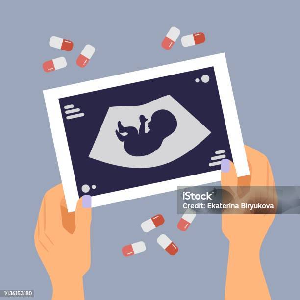 Robek Tembakan Usg Di Tangan Dengan Pil Di Latar Belakang Aborsi ... Robek Tembakan Usg Di Tangan Dengan Pil Di Latar Belakang Aborsi ...