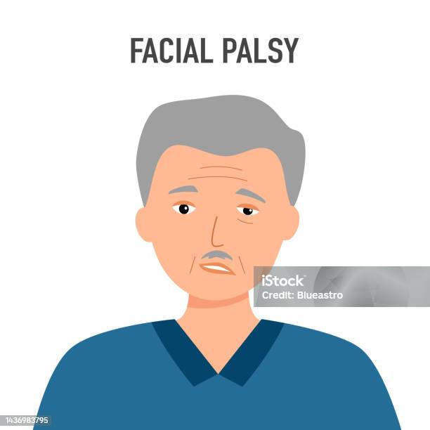 Senior Facial Nerve Paralysis Concept Vector Illustration Face Palsy ... Senior Facial Nerve Paralysis Concept Vector Illustration Face Palsy ...