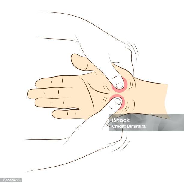 Hand Massage Closeup Physiotherapist Presses Special Points On Female Palm To Relieve Headaches