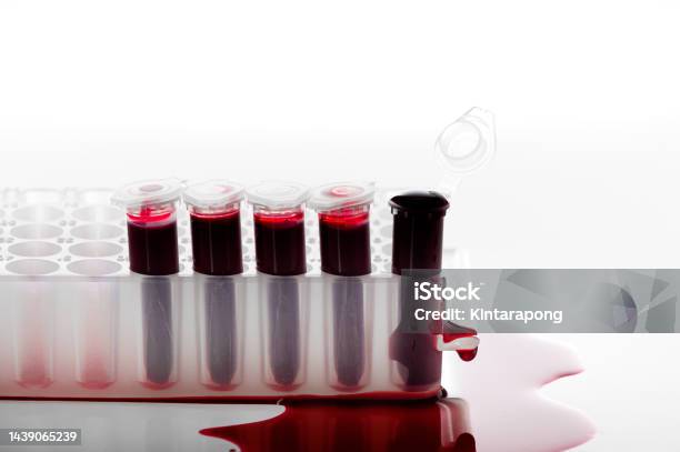 Broken Blood Sample Pcr Tube Or Red Liquid On Pcr Plate In The ... Broken Blood Sample Pcr Tube Or Red Liquid On Pcr Plate In The ...