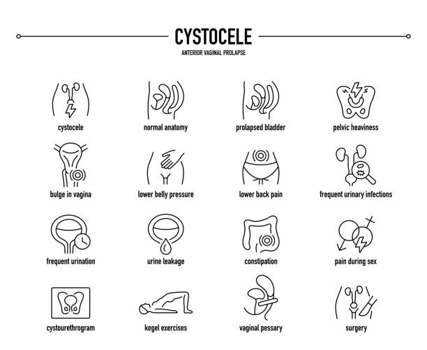 110 Pelvic Floor Ilustrasi Grafik Vektor And Clip Art Bebas Royalti