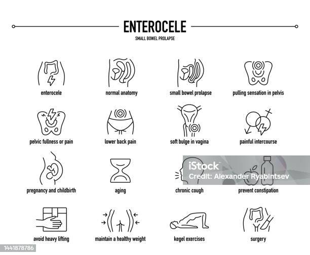 Enterocele Set Ikon Vektor Prolaps Usus Kecil Ilustrasi Stok Unduh
