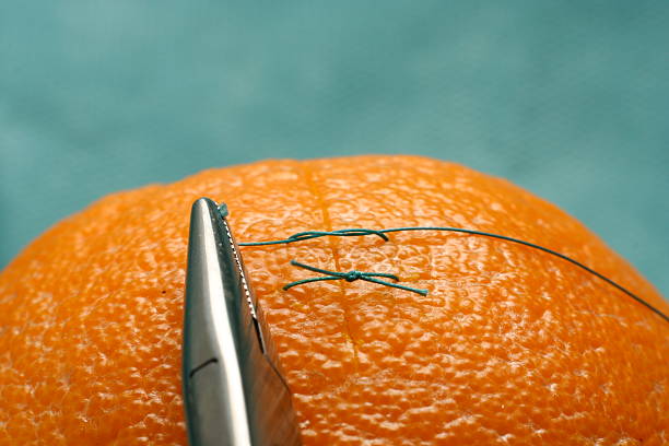 suturing Premium Photos, Pictures and Images by Istock