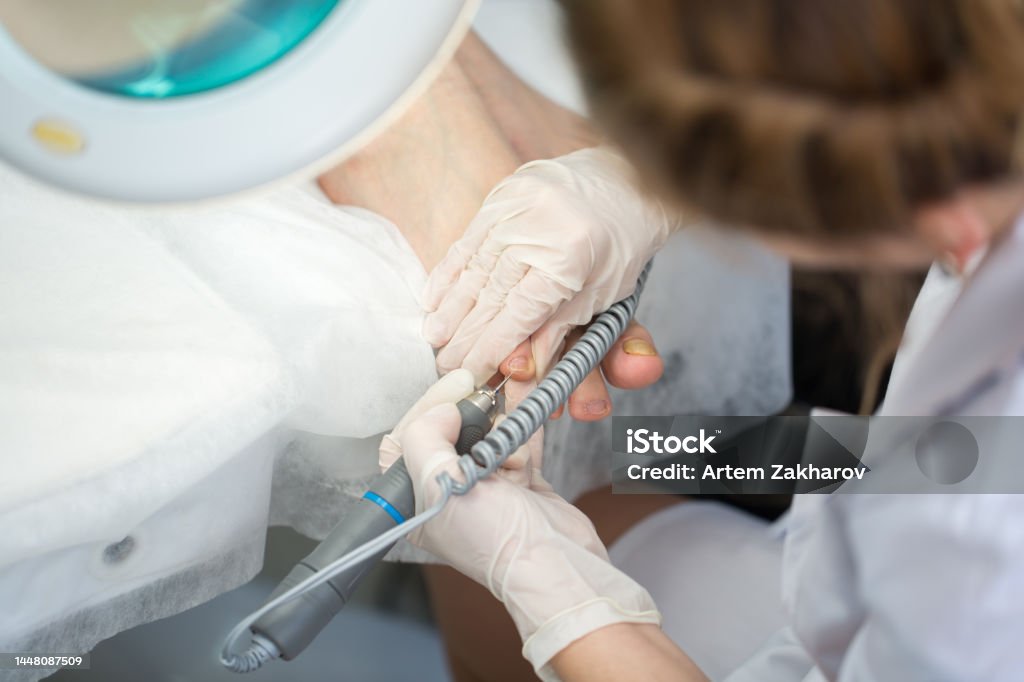 Podiatry Procedure With Pedicure Machine Care Of The Feet Stock Photo ... Podiatry Procedure With Pedicure Machine Care Of The Feet Stock Photo ...