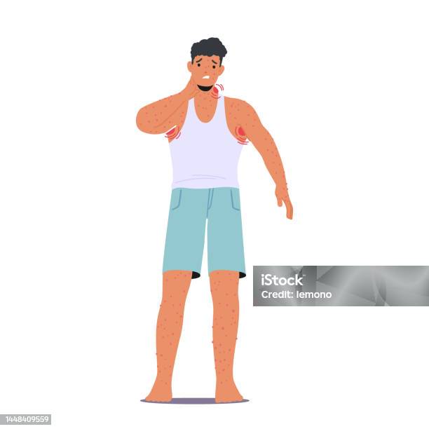 Monkey Pox Outbreak Concept Sick Male Character With Monkeypox Virus ... Monkey Pox Outbreak Concept Sick Male Character With Monkeypox Virus ...