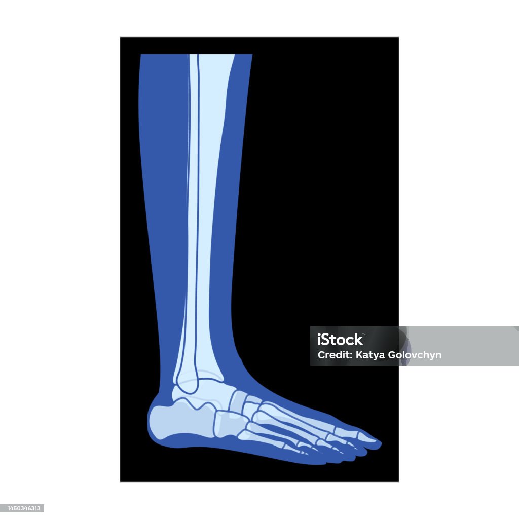Xray Foot Legs Skeleton Fibula Tibia Phalanges Human Body Bones Adult