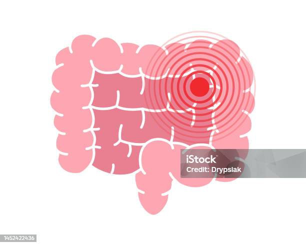 Simbol Nyeri Usus Manusia Usus Sakit Ikon Ilustrasi Vektor Tubuh ... Simbol Nyeri Usus Manusia Usus Sakit Ikon Ilustrasi Vektor Tubuh ...