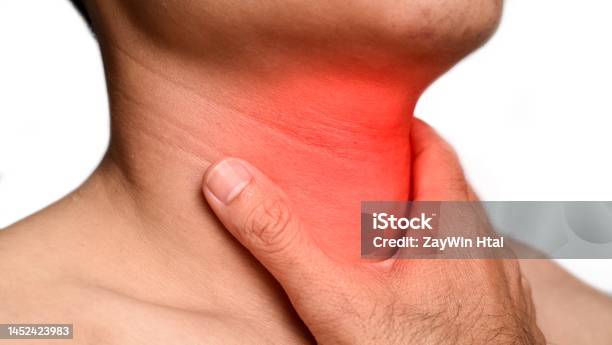 Redness At Neck Of Asian Man Concept Of Sore Throat Pharyngitis