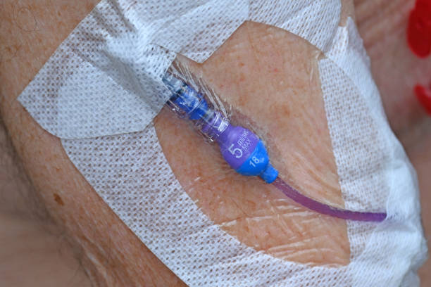 20+ Peripherally Inserted Central Catheter Stock Photos, Pictures ... 20+ Peripherally Inserted Central Catheter Stock Photos, Pictures ...