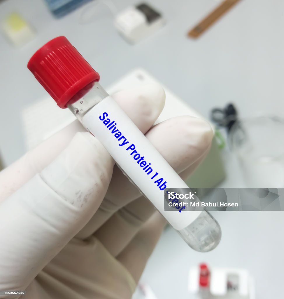 Scientist Holding Sample For Salivary Protein Ab Test Salivary Protein ... Scientist Holding Sample For Salivary Protein Ab Test Salivary Protein ...