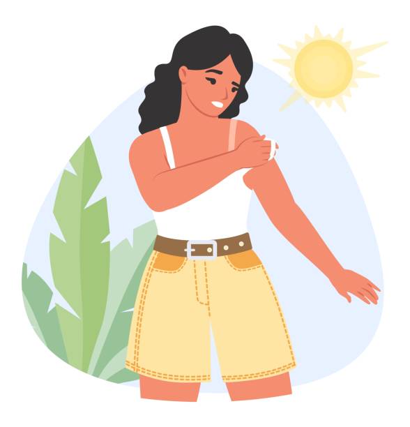 7 600 Sunburn Illustration Stock Illustrations Royalty Free Vector