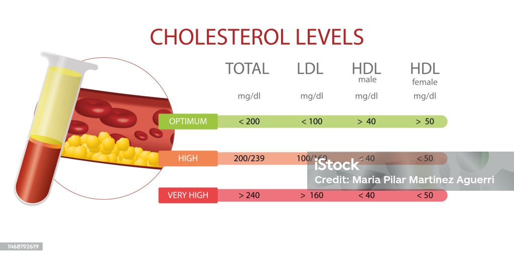 Cholesterol Levels Infographic Stock Illustration - Download Image Now ... Cholesterol Levels Infographic Stock Illustration - Download Image Now ...