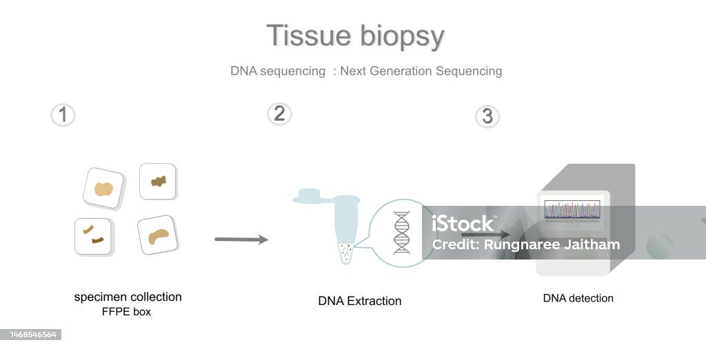 Alur Kerja Pengurutan Dna Dalam Sampel Biopsi Jaringan Dengan Teknik ... Alur Kerja Pengurutan Dna Dalam Sampel Biopsi Jaringan Dengan Teknik ...