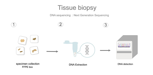 The Workflow Of Dna Sequencing In The Sample Of Tissue Biopsy With Next