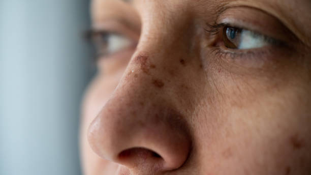 Scar Face Pictures | Download Free Images on Unsplash