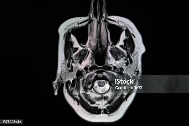 Pemindaian Mri Otak Pemindaian Gambar Resonansi Magnetik Otak Alat ... Pemindaian Mri Otak Pemindaian Gambar Resonansi Magnetik Otak Alat ...