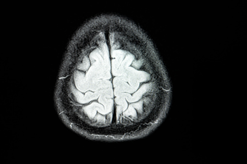 Pemindaian Mri Otak Pemindaian Gambar Resonansi Magnetik Otak Alat ... Pemindaian Mri Otak Pemindaian Gambar Resonansi Magnetik Otak Alat ...