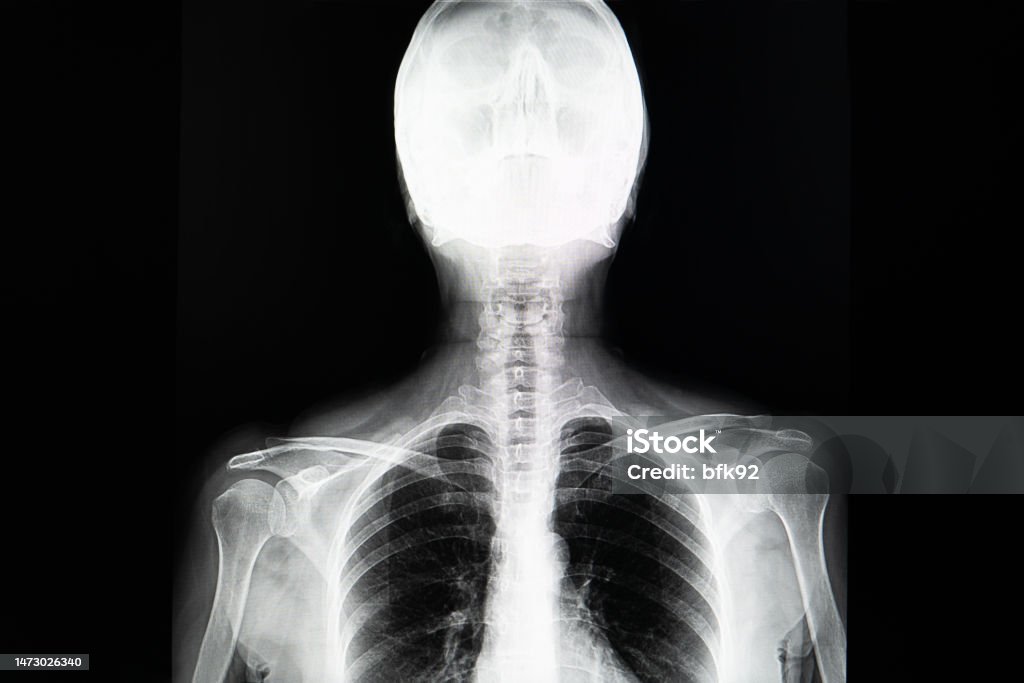 Pemindaian Mri Otak Pemindaian Gambar Resonansi Magnetik Otak Alat ... Pemindaian Mri Otak Pemindaian Gambar Resonansi Magnetik Otak Alat ...