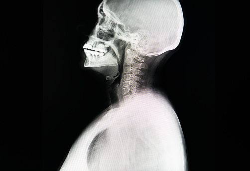 Pemindaian Mri Otak Pemindaian Gambar Resonansi Magnetik Otak Alat ... Pemindaian Mri Otak Pemindaian Gambar Resonansi Magnetik Otak Alat ...