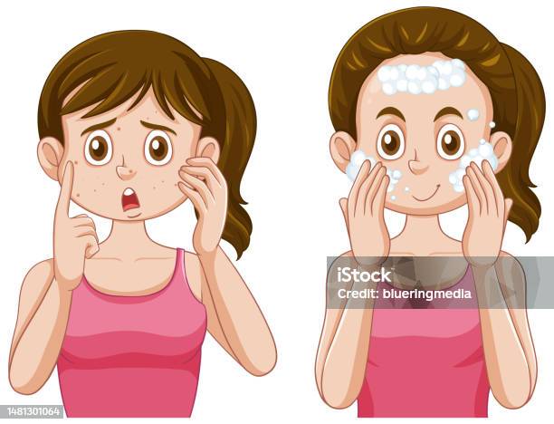 Puberty Girl Worry About Her Skin Face Stok Vektör Sanatı And Akne‘nin