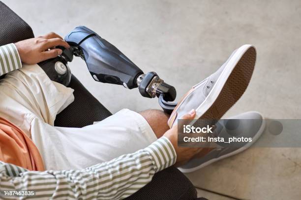 Pria Yang Diamputasi Dengan Prostesis Kaki Di Atas Lutut Duduk Di Sofa