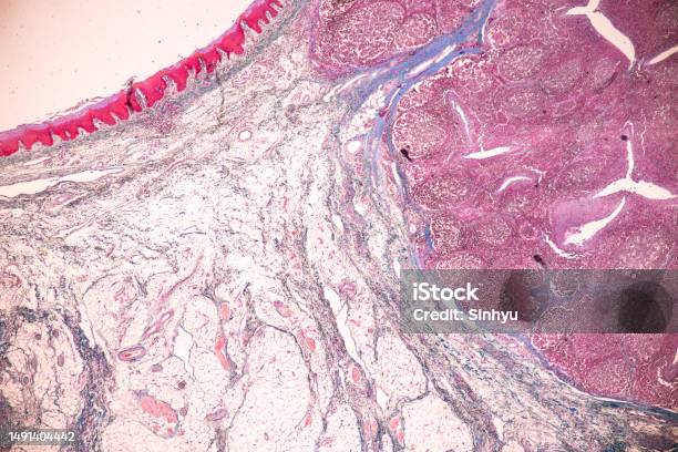 Adipose Tissue Human Soft Palate Human Bone Human And Striated Muscle Human Under The Microscope